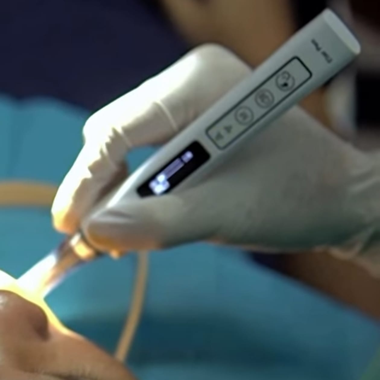 Suntik Gigi Tidak Lagi Sakit Pakai Alat Ini - Implan Gigi Surabaya